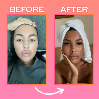 GLOW DARK INTENSE TANNING GEL – GlowUP Tanning